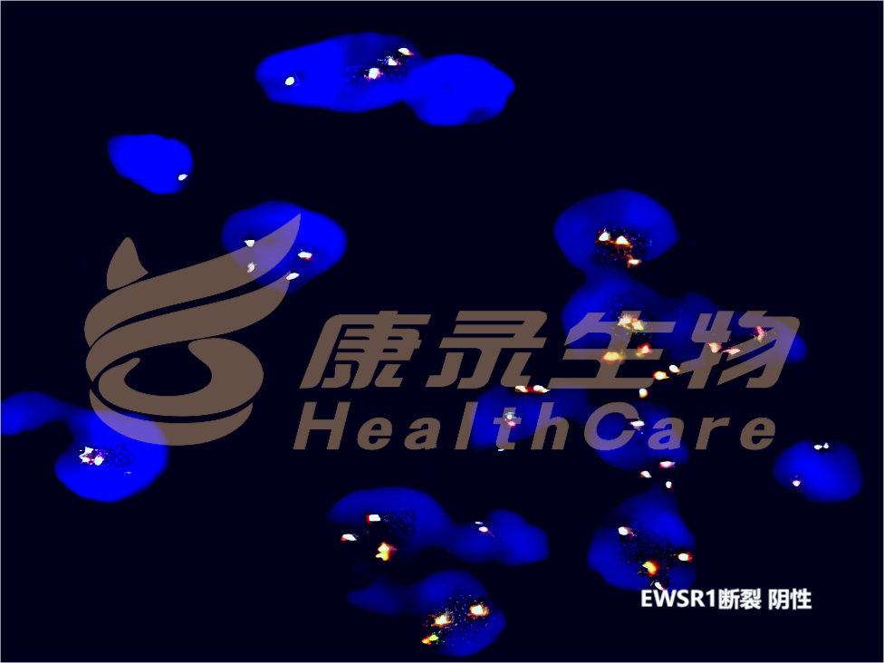 EWSR1基因断裂探针试剂（原位杂交法）-武汉康录生物技术股份有限公司